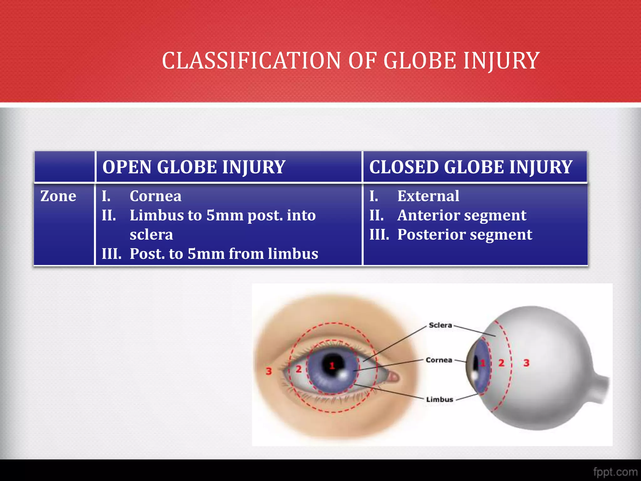 Ocular Injuries – Classification & Management Protocol.pptx