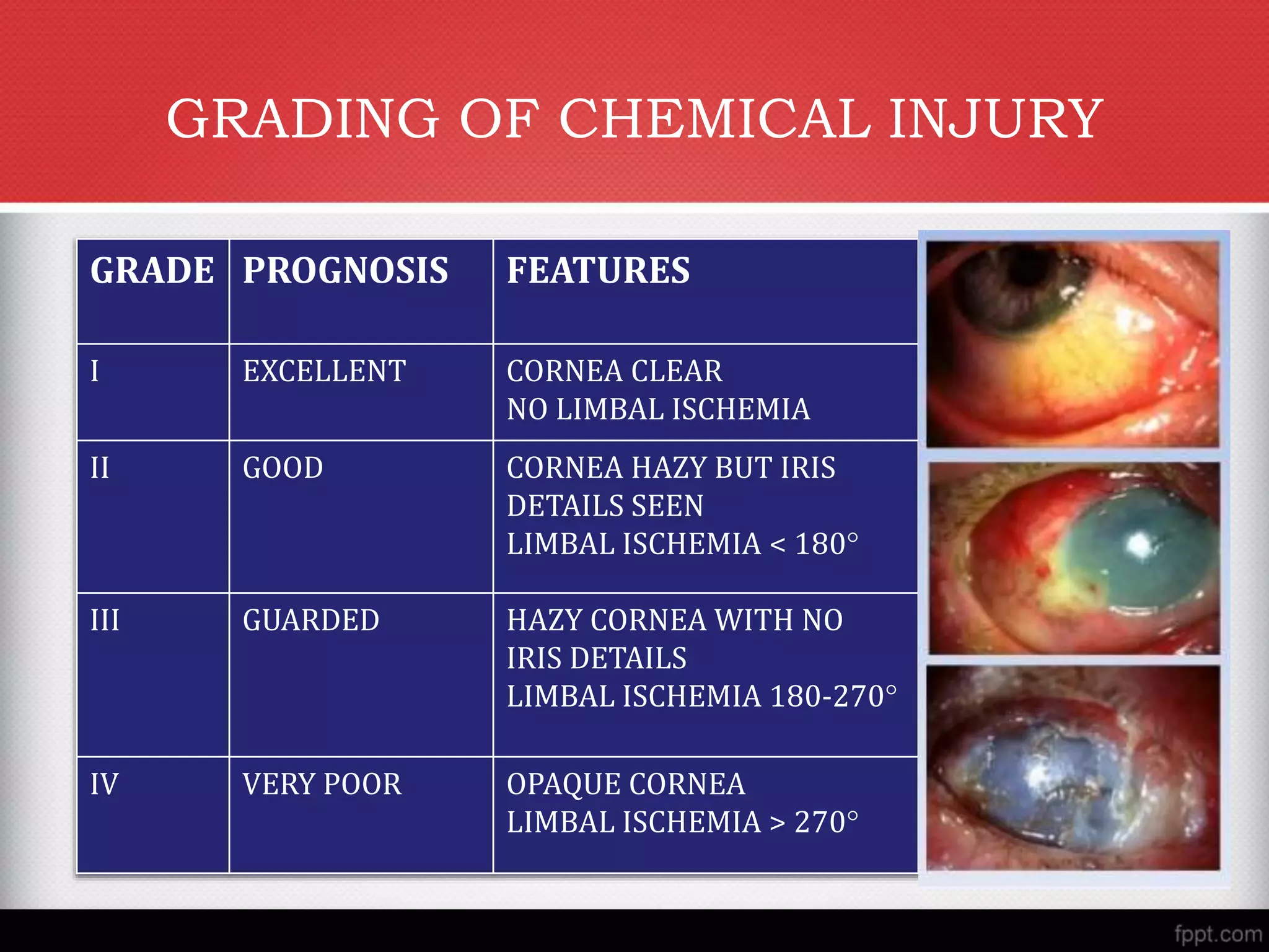 Ocular Injuries – Classification & Management Protocol.pptx