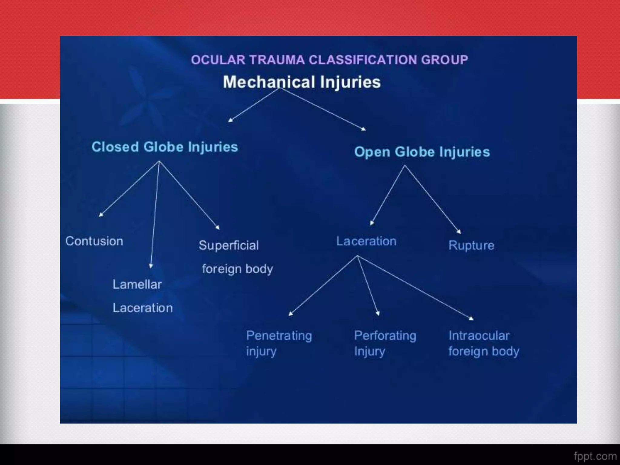 Ocular Injuries – Classification & Management Protocol.pptx