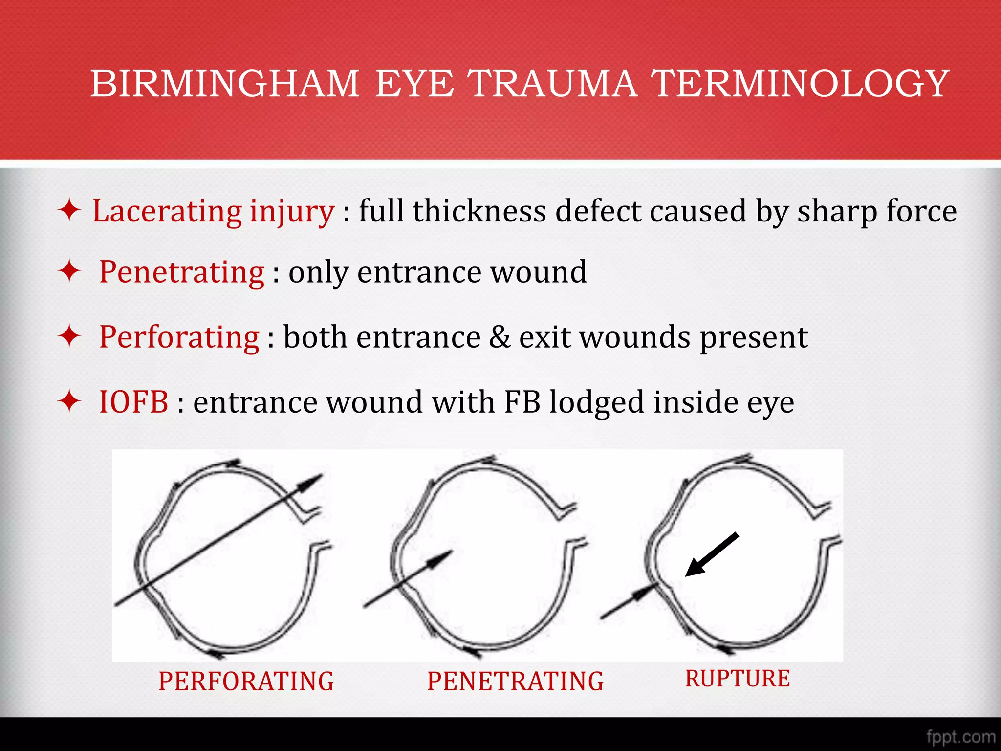 Ocular Injuries – Classification & Management Protocol.pptx