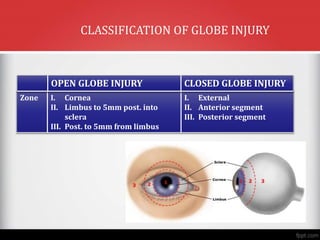 Ocular Injuries – Classification & Management Protocol.pptx