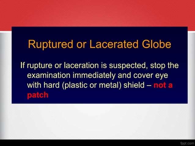 Ocular Injuries – Classification & Management Protocol.pptx