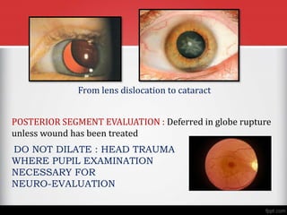 Ocular Injuries – Classification & Management Protocol.pptx