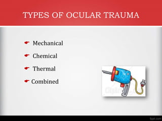 Ocular Injuries – Classification & Management Protocol.pptx