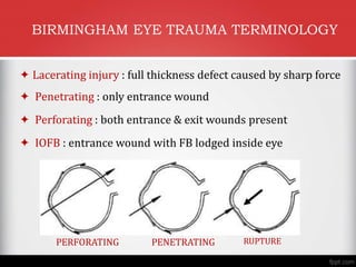 Ocular Injuries – Classification & Management Protocol.pptx