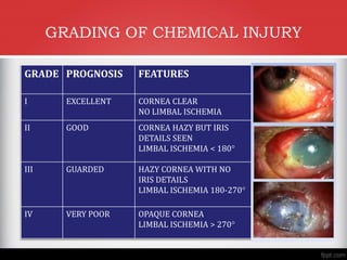Ocular Injuries – Classification & Management Protocol.pptx