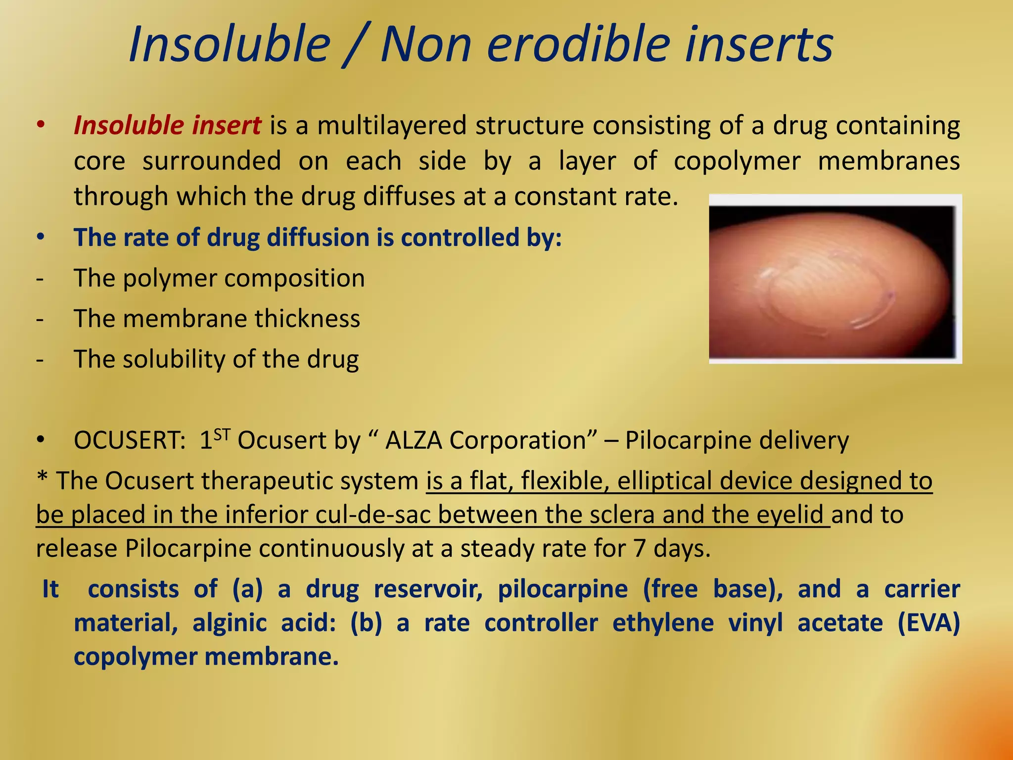Ocular inserts | PPTX