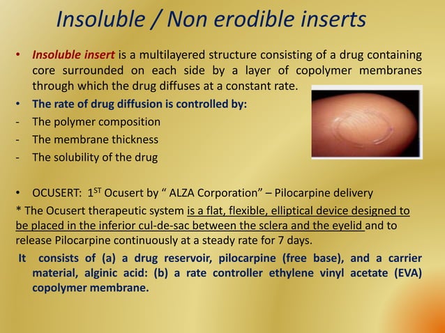 Ocular inserts | PPTX