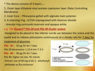 Ocular inserts | PPTX