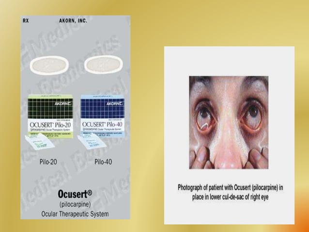 Ocular inserts