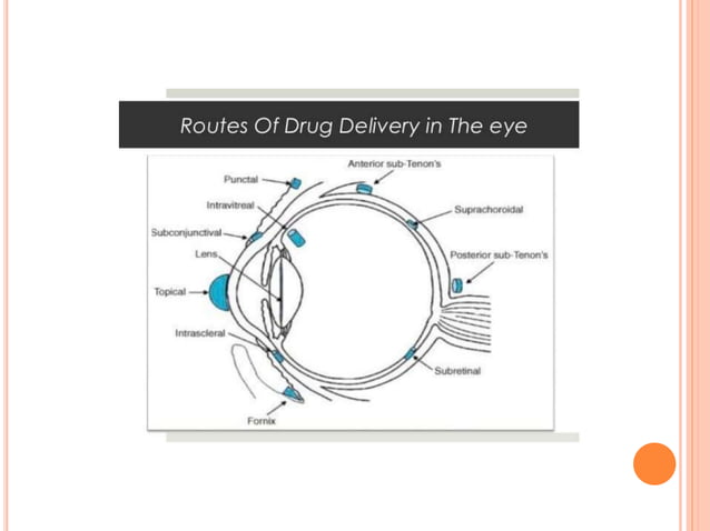 Ocular inserts | PPTX