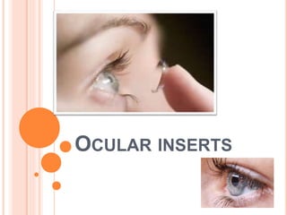Ocular inserts | PPTX