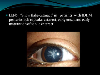 Ocular manfestations | PPTX