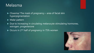 Ocular Manifestations in Pregnancy and Labour | PPT