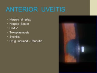 Ocular manifestations of AIDS | PPT | Eye and Vision Conditions ...