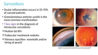ocular manifestations of autoimmune disease.pptx