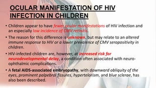 Ocular manifestations of hiv | PPTX