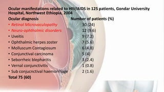 Ocular manifestations of hiv | PPTX