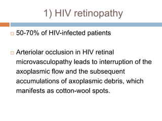 Hiv Retinopathy Oct