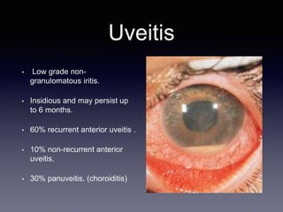 Ocular Manifestations of Inflammatory Bowel Disease | PPTX | Eye and ...