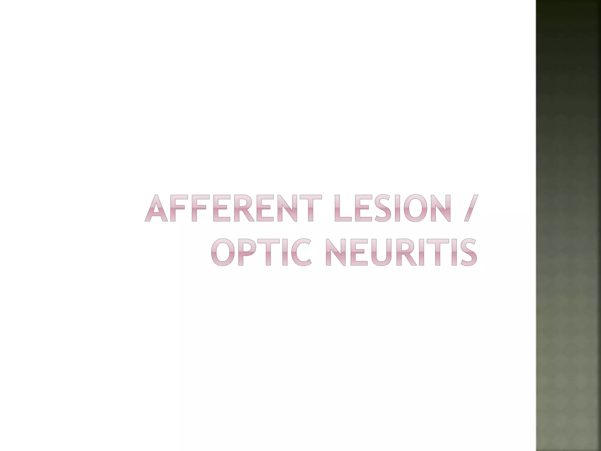 Ocular manifestations of multiple sclerosis | PPTX