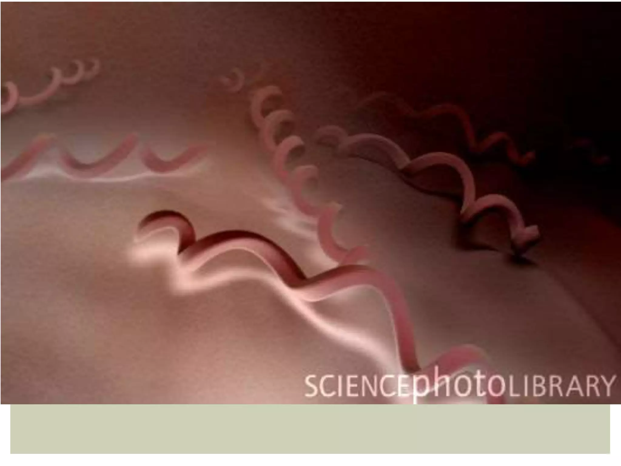 Ocular manifestations of syphilis | PPTX