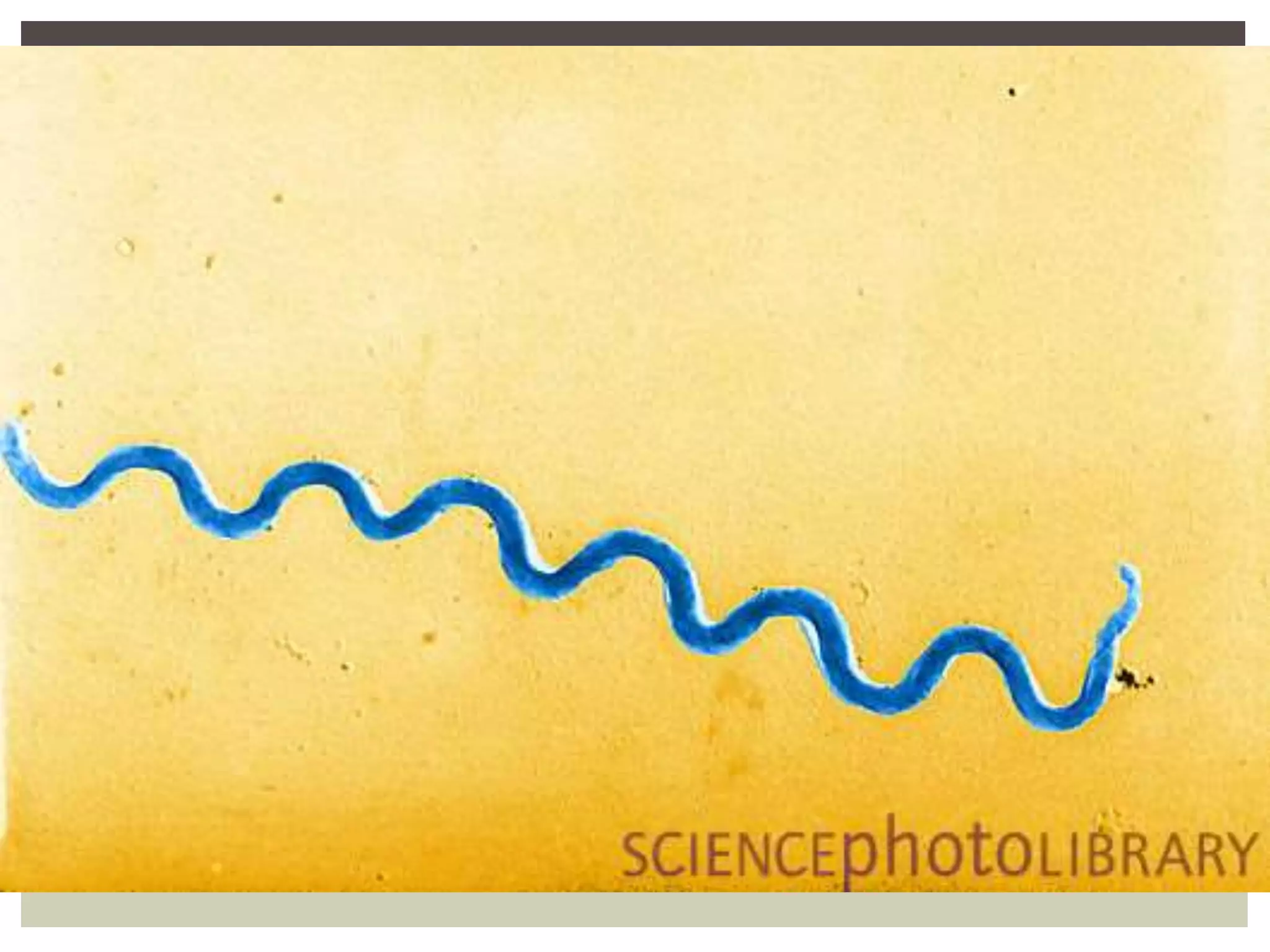 Ocular manifestations of syphilis | PPTX