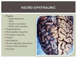 Ocular manifestations of syphilis | PPTX