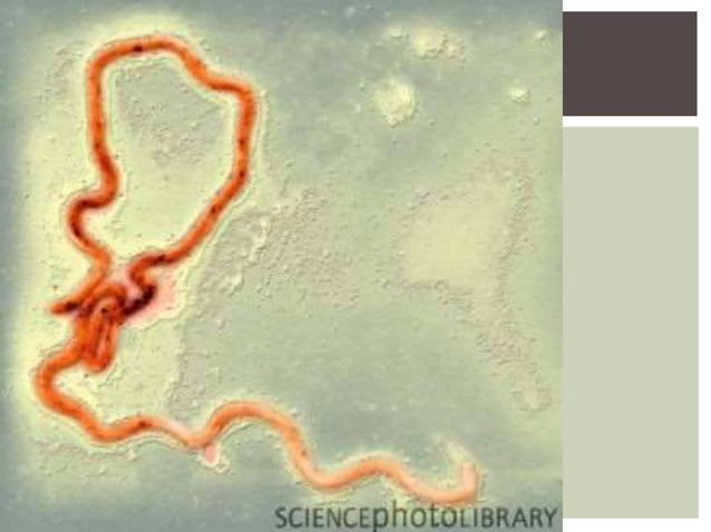 Ocular manifestations of syphilis