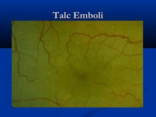 Ocular manifestations of systemic disease | PPT