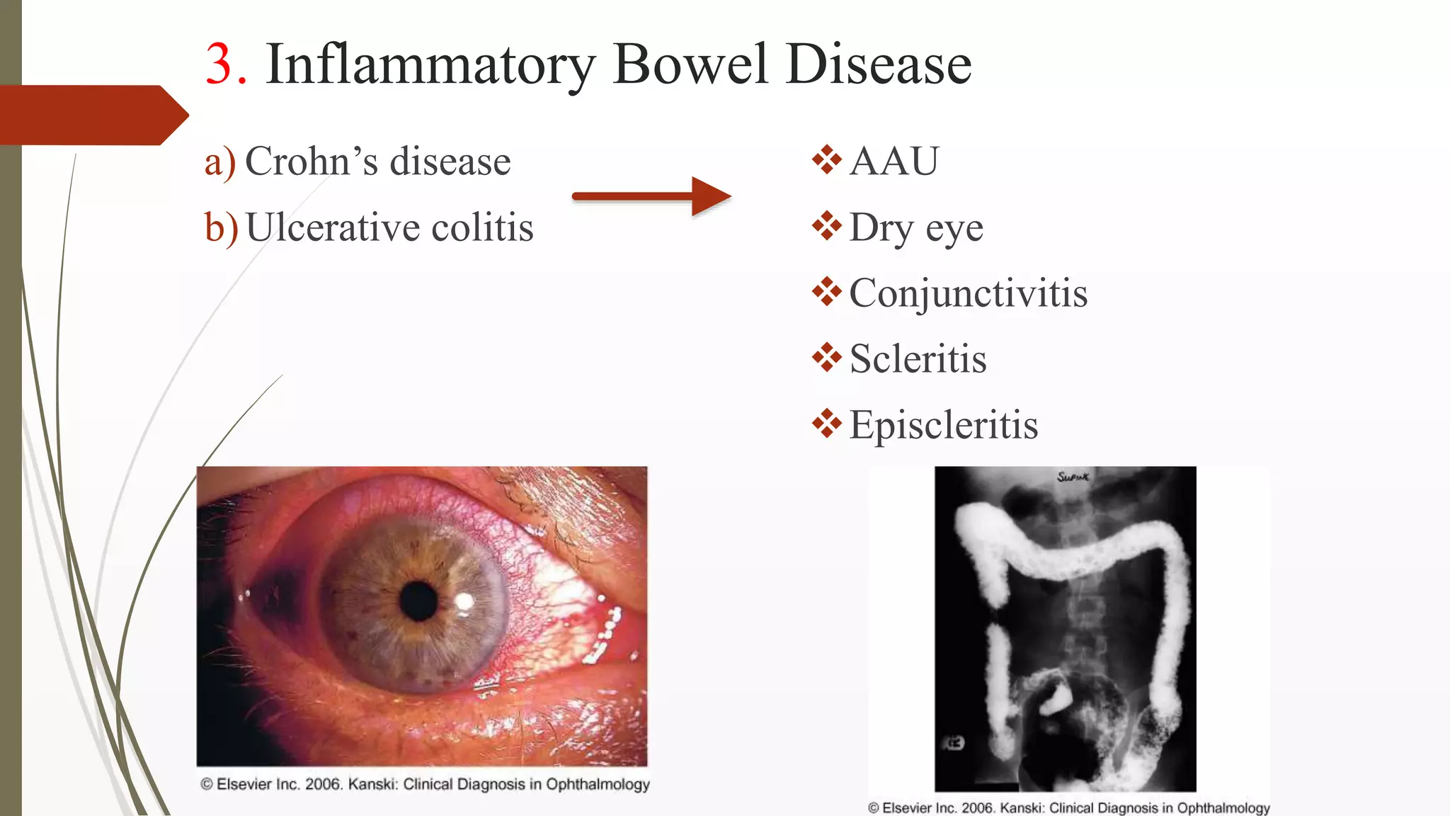Ocular manifestations of systemic diseases | PPTX