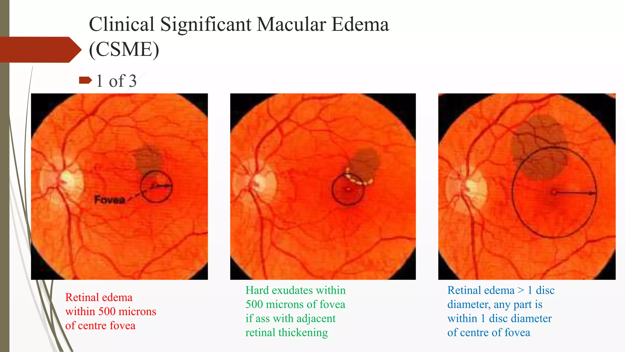 Ocular manifestations of systemic diseases | PPTX