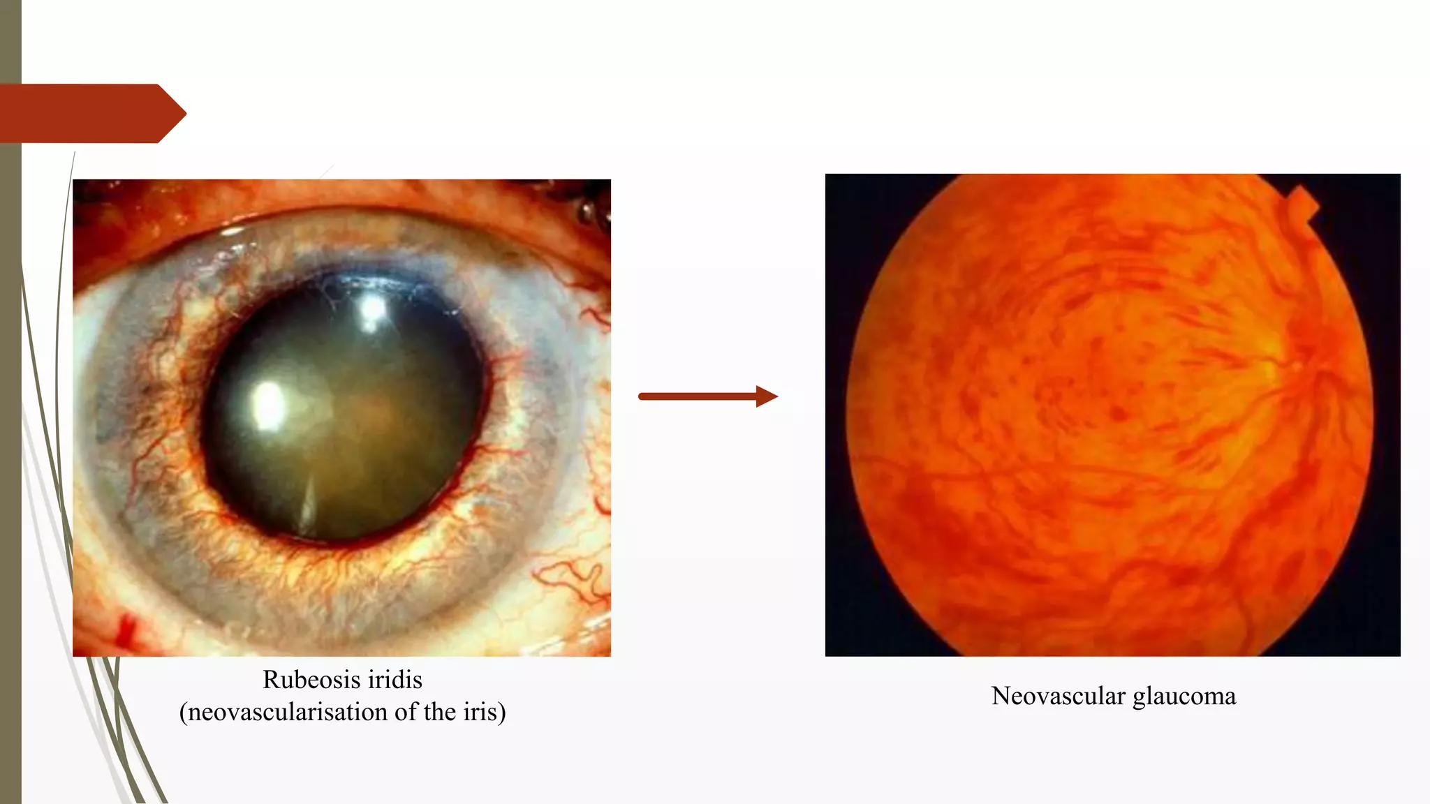 Ocular manifestations of systemic diseases | PPTX