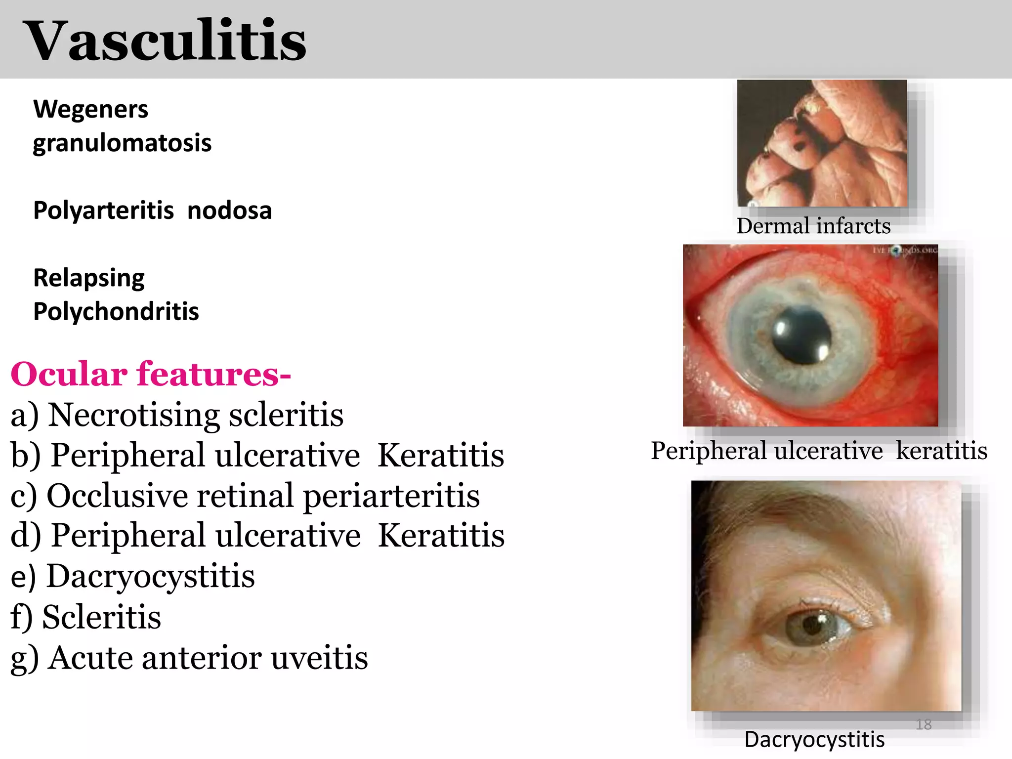 Ocular_manifestations_of_systemic_ds..pptx