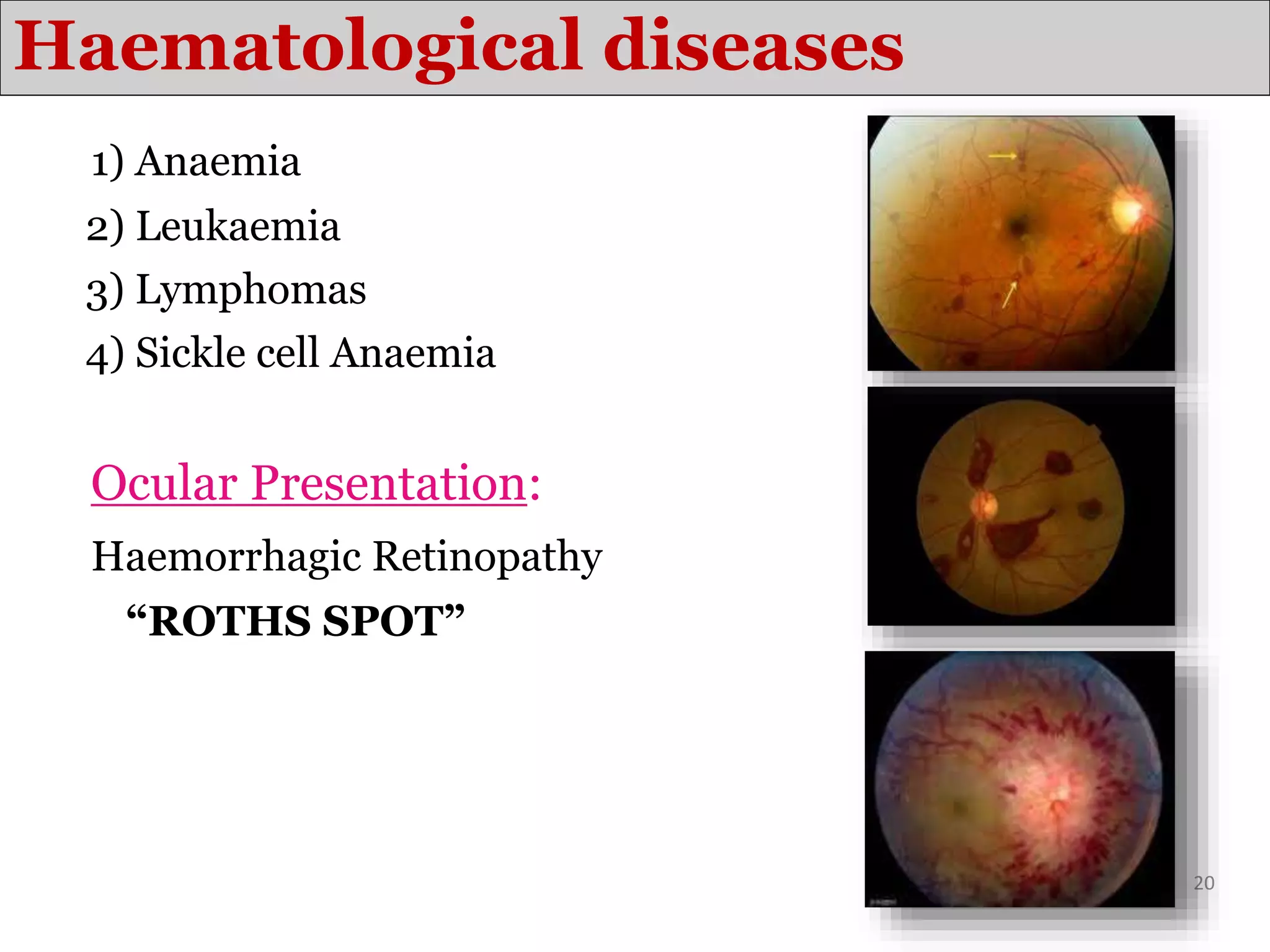 Ocular_manifestations_of_systemic_ds..pptx