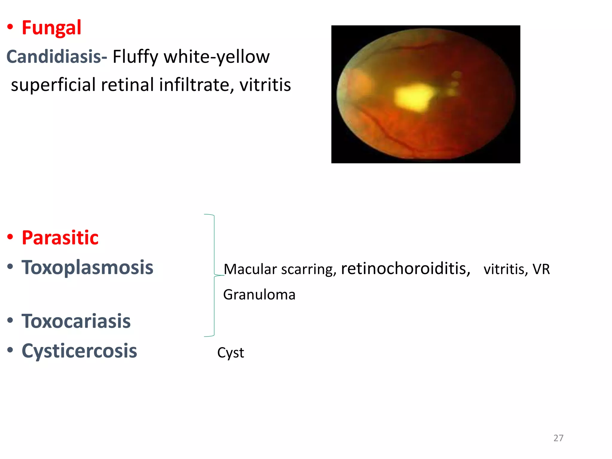 Ocular_manifestations_of_systemic_ds..pptx