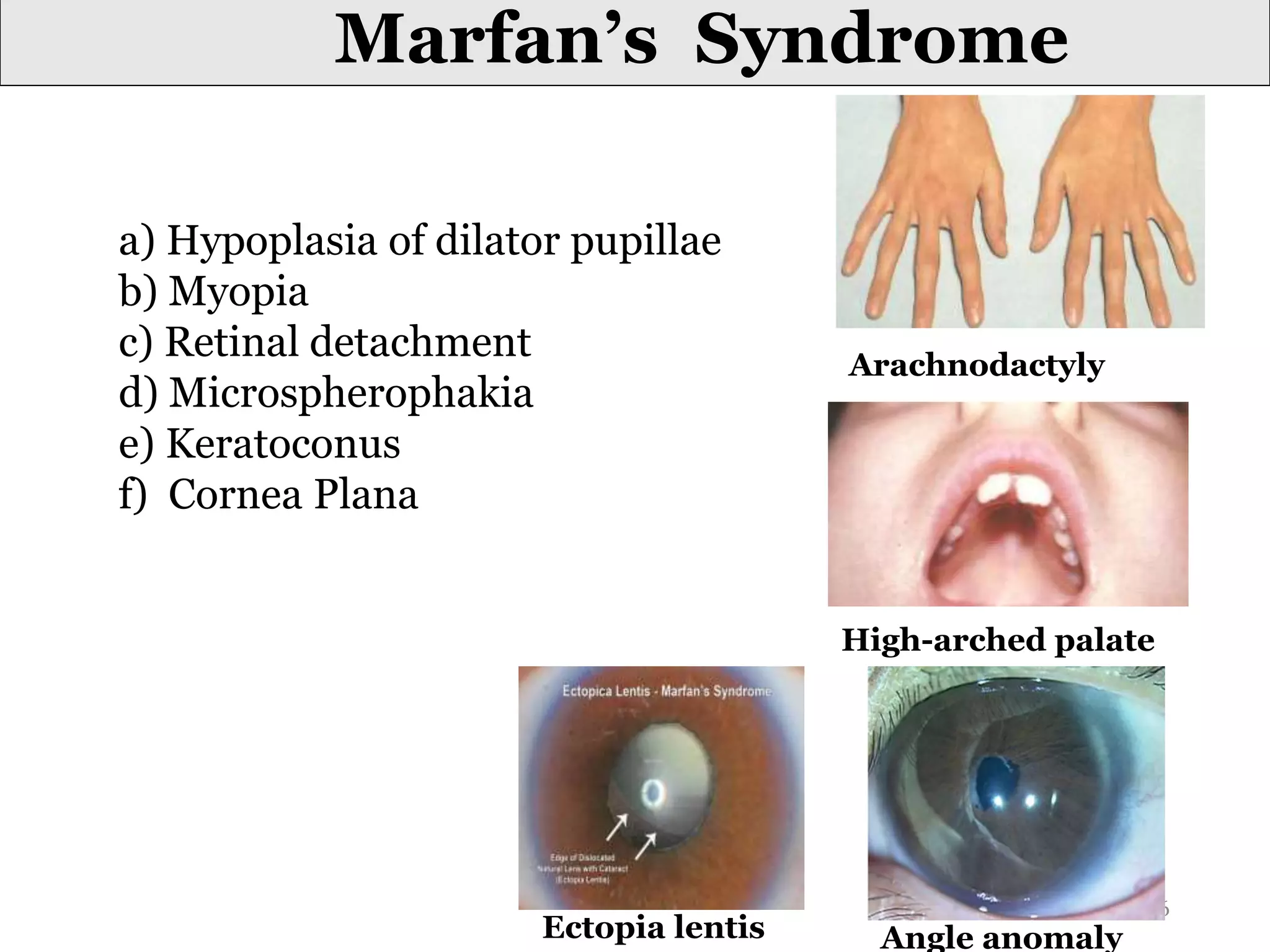Ocular_manifestations_of_systemic_ds..pptx