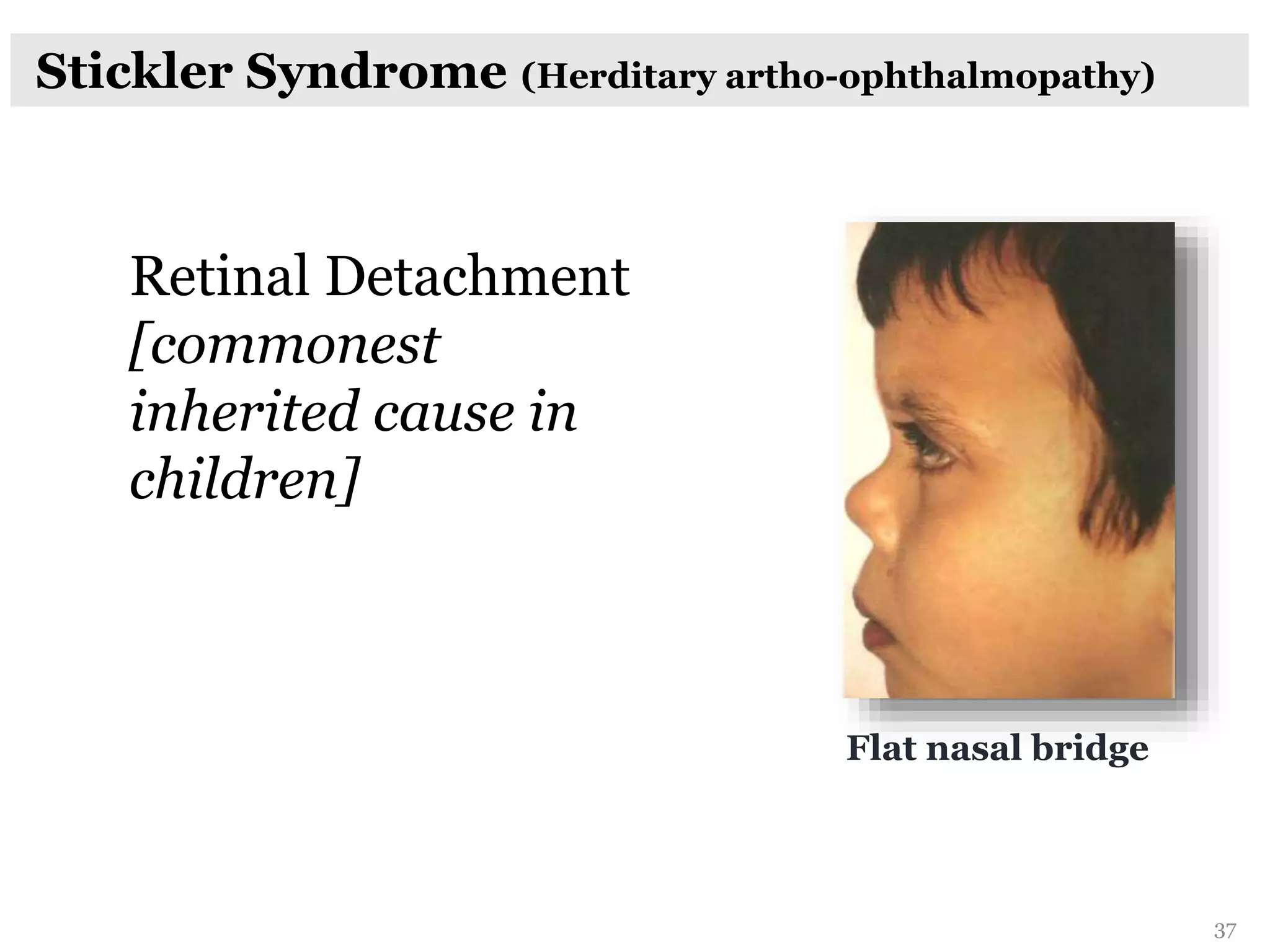 Ocular_manifestations_of_systemic_ds..pptx