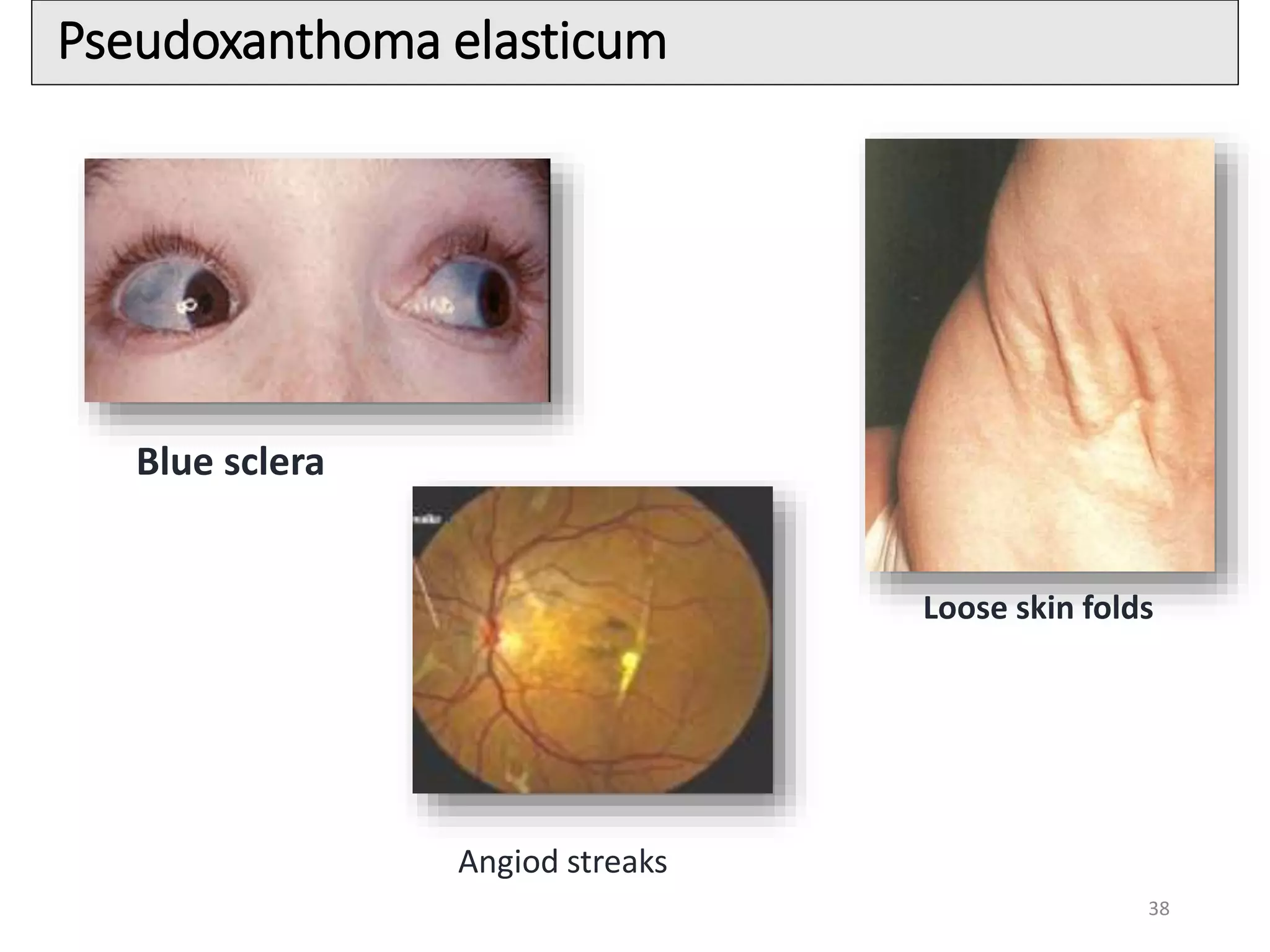 Ocular_manifestations_of_systemic_ds..pptx