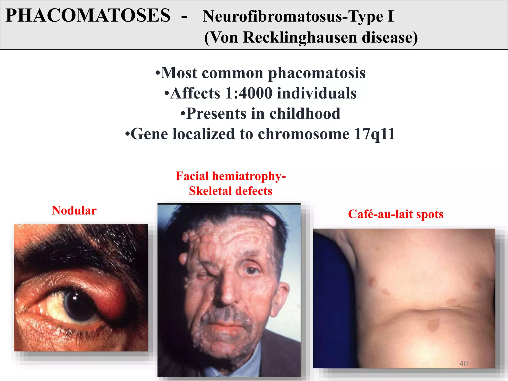 Ocular_manifestations_of_systemic_ds..pptx