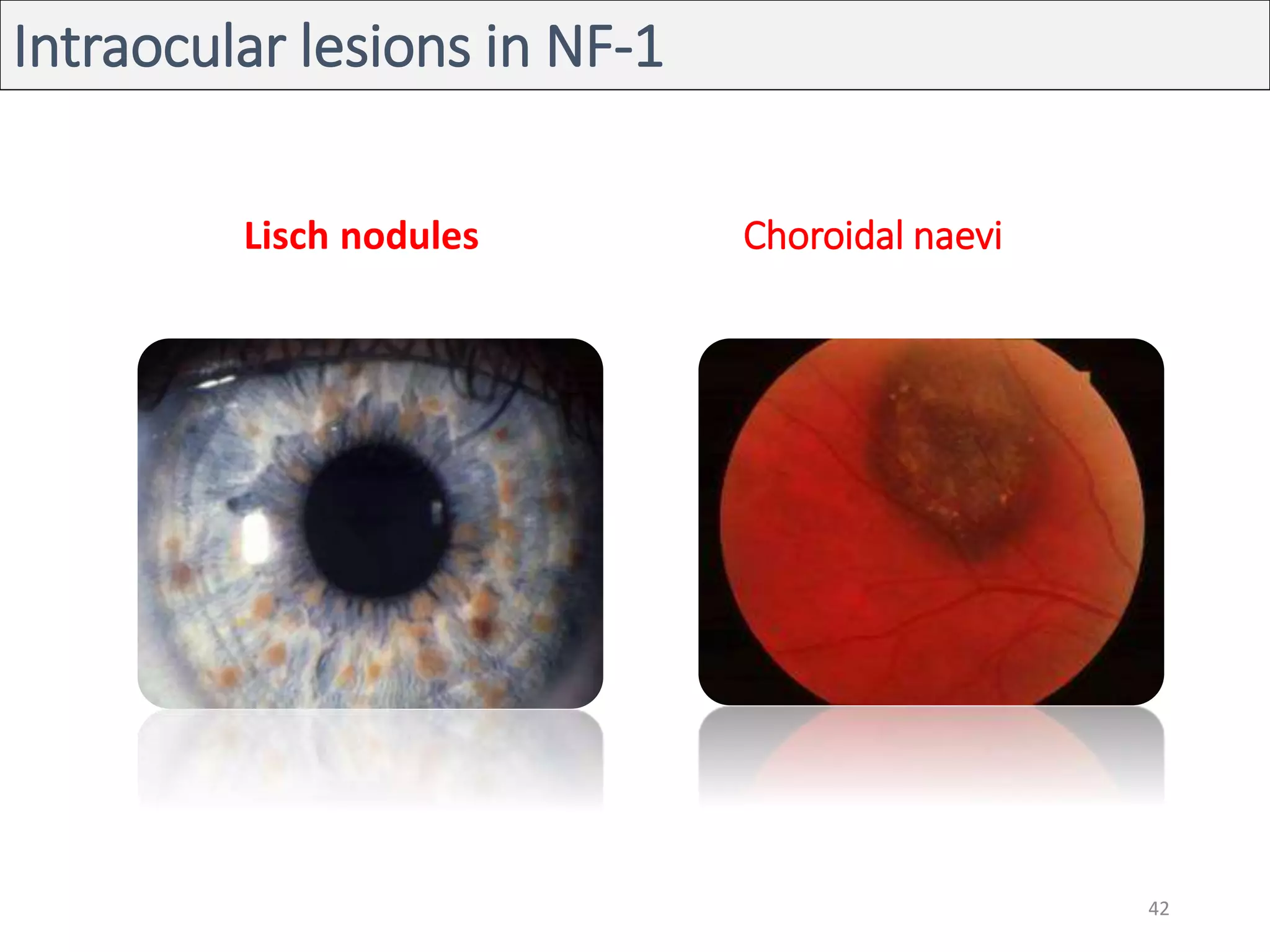 Ocular_manifestations_of_systemic_ds..pptx