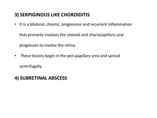 OCULAR MANIFESTATIONS OF TB.pptx