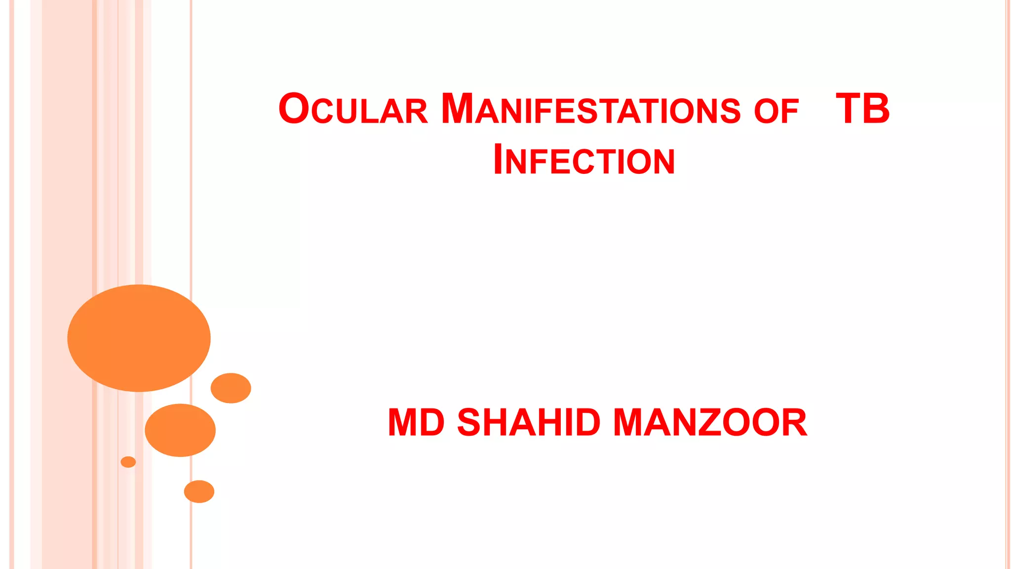 Ocular manifestations of tuberculosis infection | PPTX