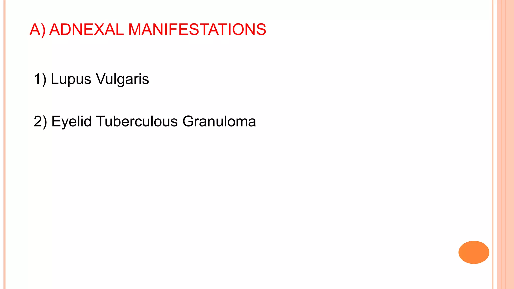 Ocular manifestations of tuberculosis infection | PPTX