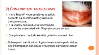 Ocular manifestations of tuberculosis infection | PPTX