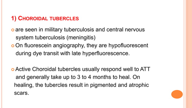 Ocular manifestations of tuberculosis infection | PPTX