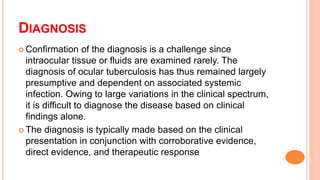 Ocular manifestations of tuberculosis infection | PPTX