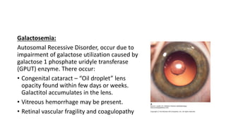 Ocular menifestation of neurological diseases | PPT