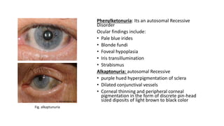Ocular menifestation of neurological diseases | PPT