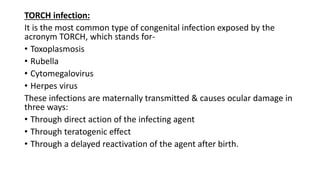 Ocular menifestation of neurological diseases | PPT